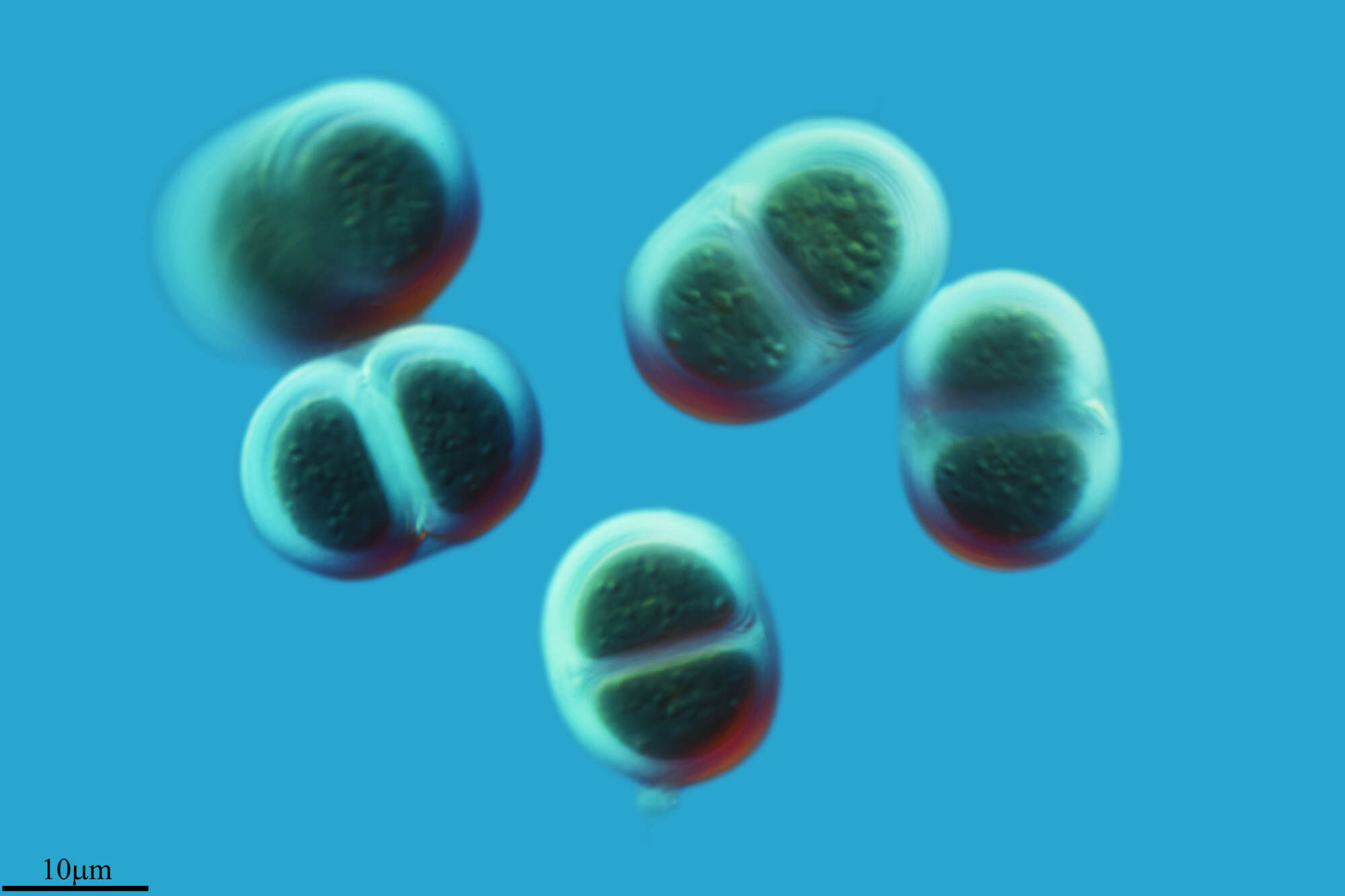 Chroococcus spelaeus | Encyclopedia MDPI