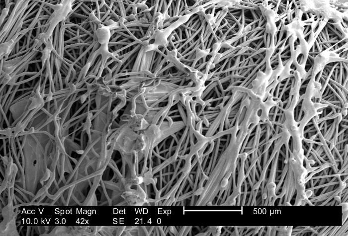 The Fibrous Configuration of a Plain Uninoculated Polyester Swab ...