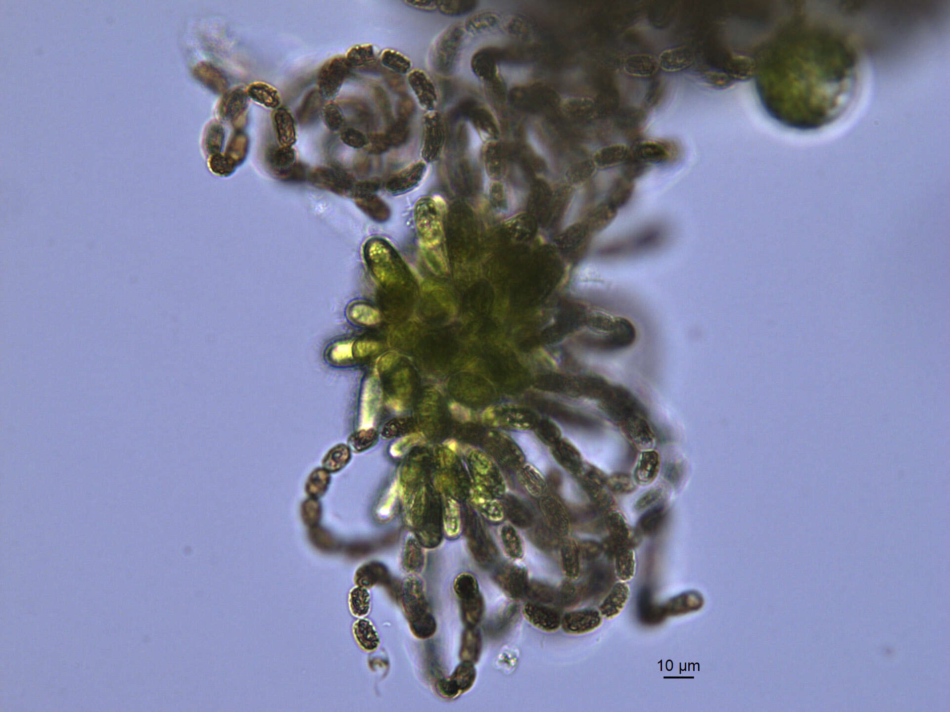 Dolichospermum lemmermannii | Encyclopedia MDPI
