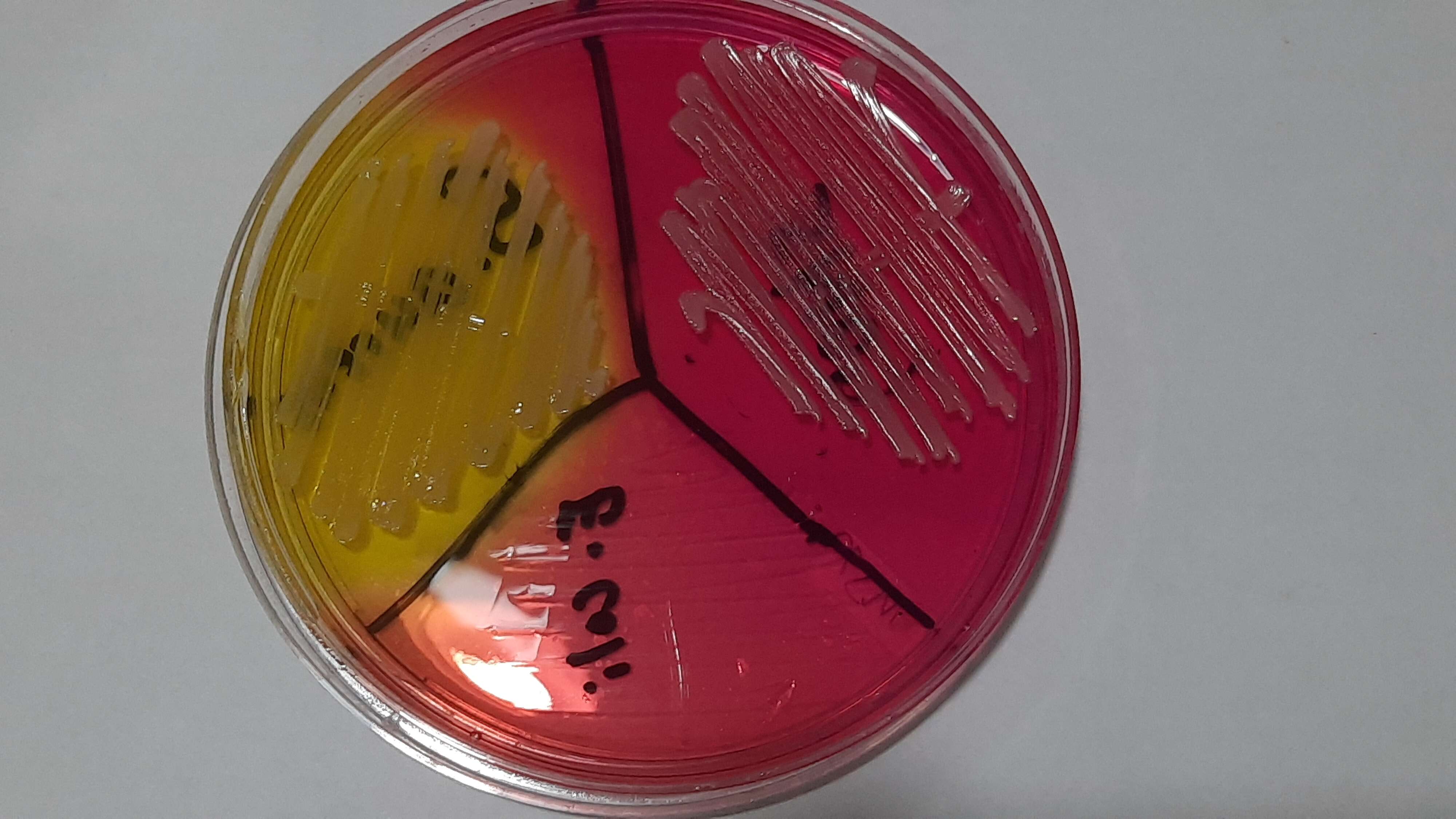 Mannitol Salt Agar | Encyclopedia MDPI