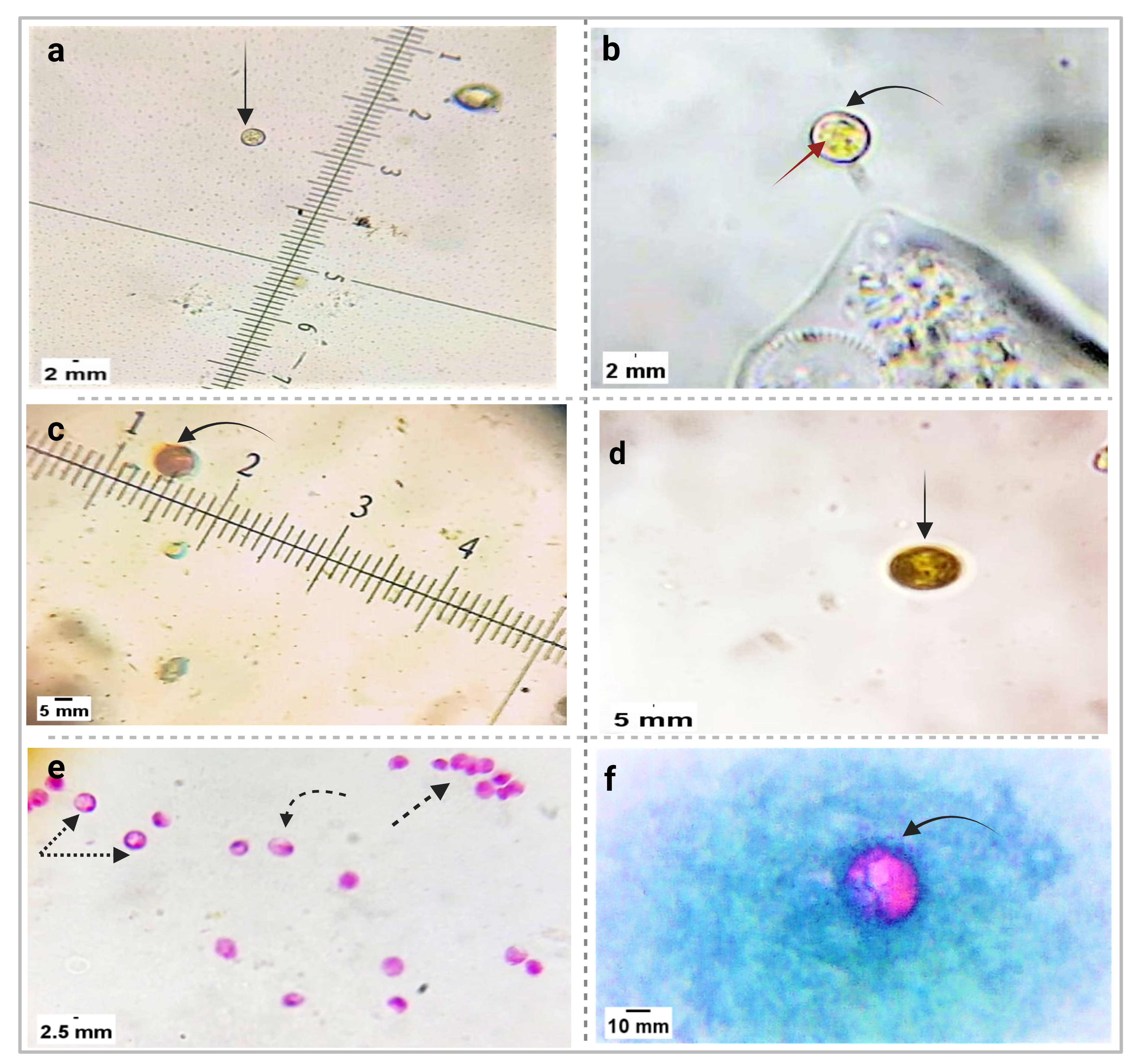 Photomicrographs Depicting the Oocysts of the Coccidian Elements: Marwa ...