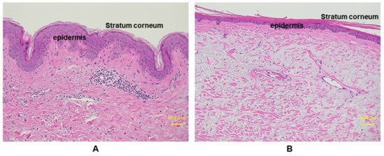 Inflammatory Response Caused by UVR | Encyclopedia MDPI