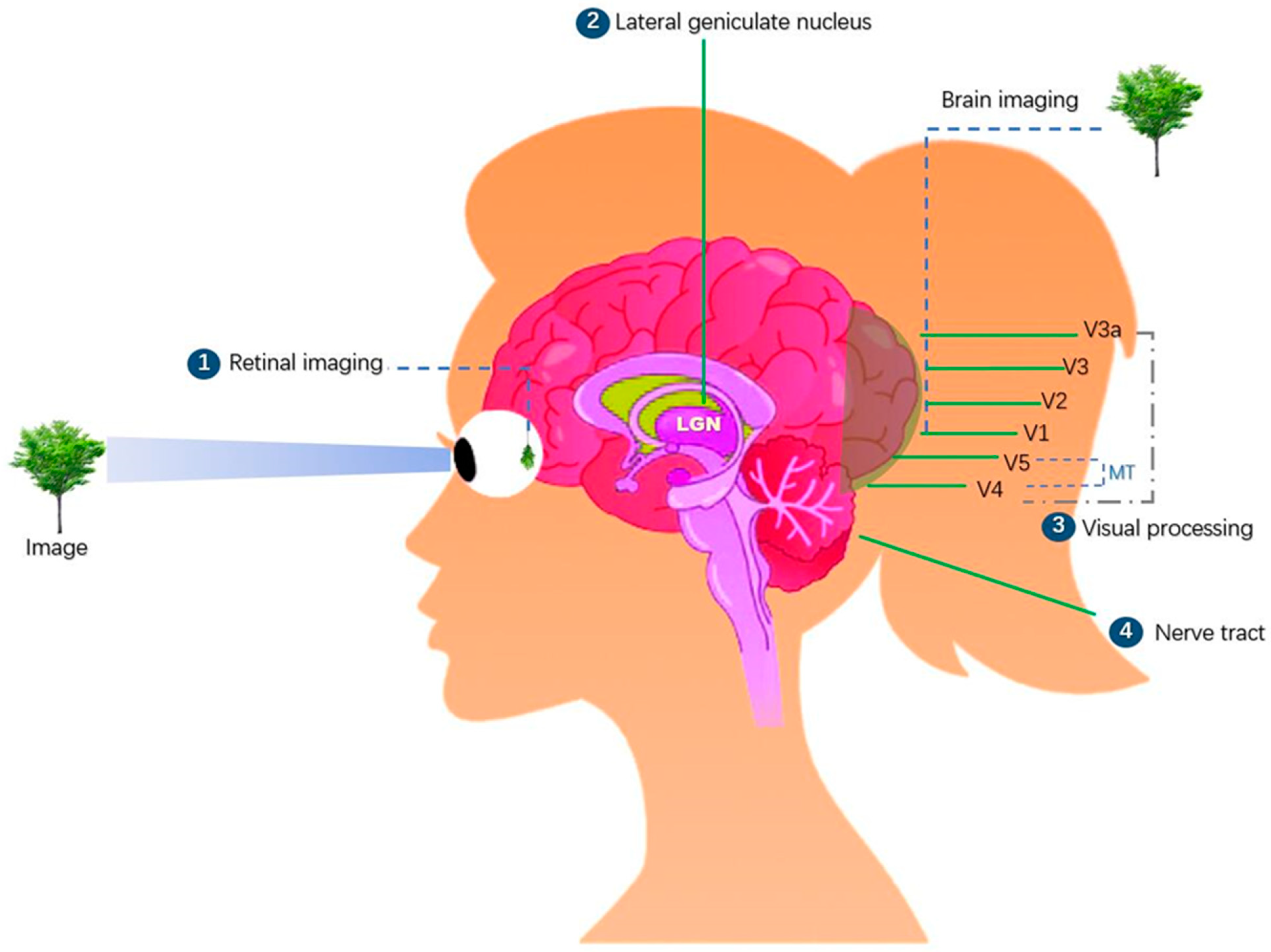 Robot Bionic Vision Technologies Encyclopedia MDPI Robot Bionic Vision Technologies Encyclopedia MDPI